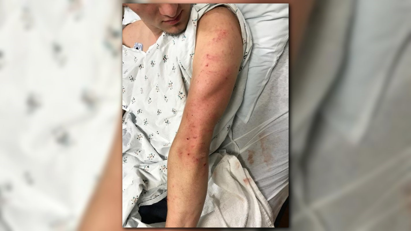 Family reunites with dog after horrific crash | wcnc.com